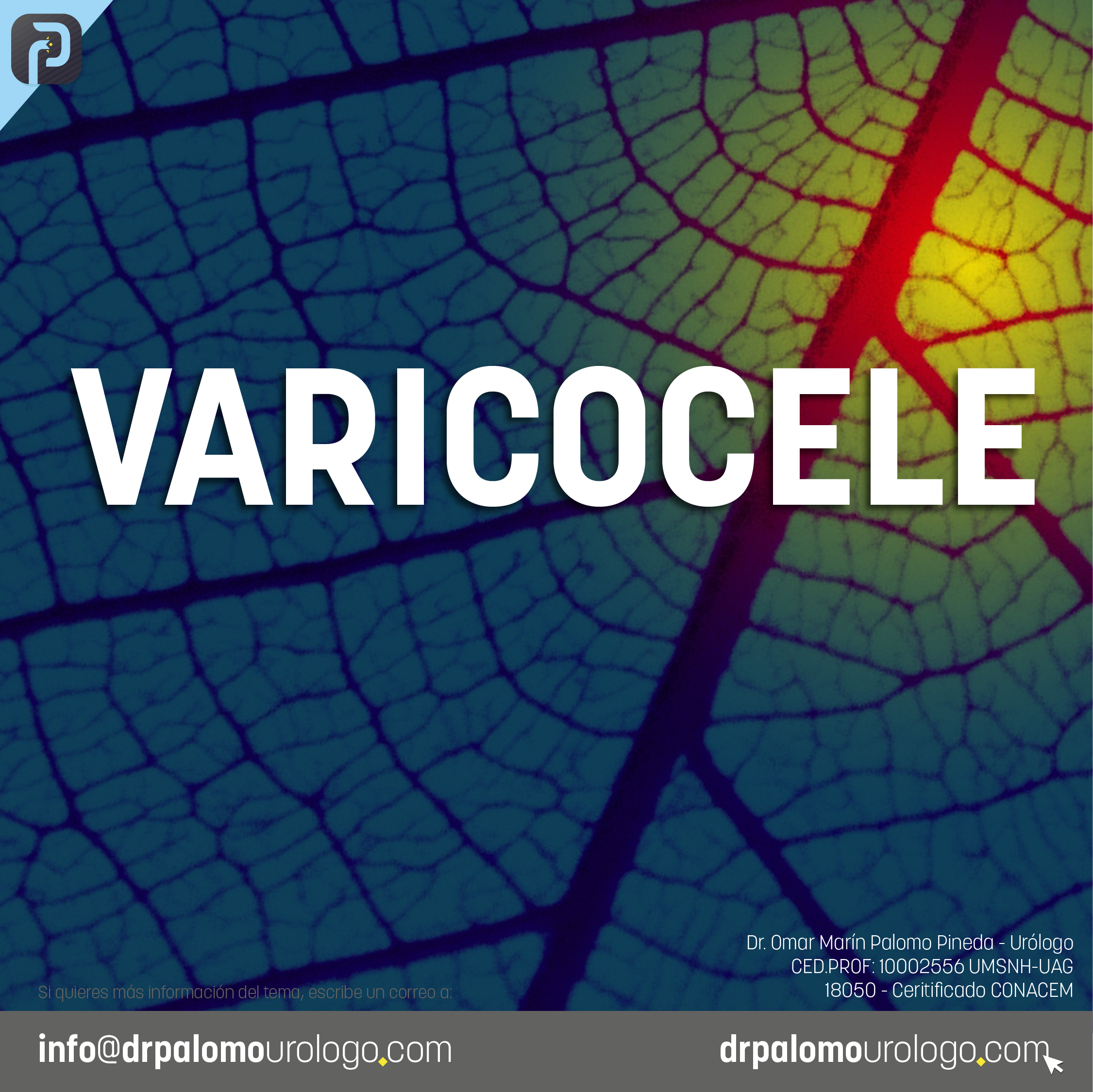 Dr Palomo Urologo | Varicocele